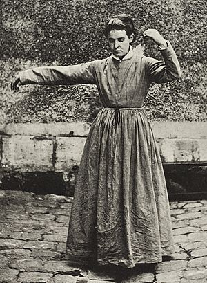 Catalepsy Facts for Kids